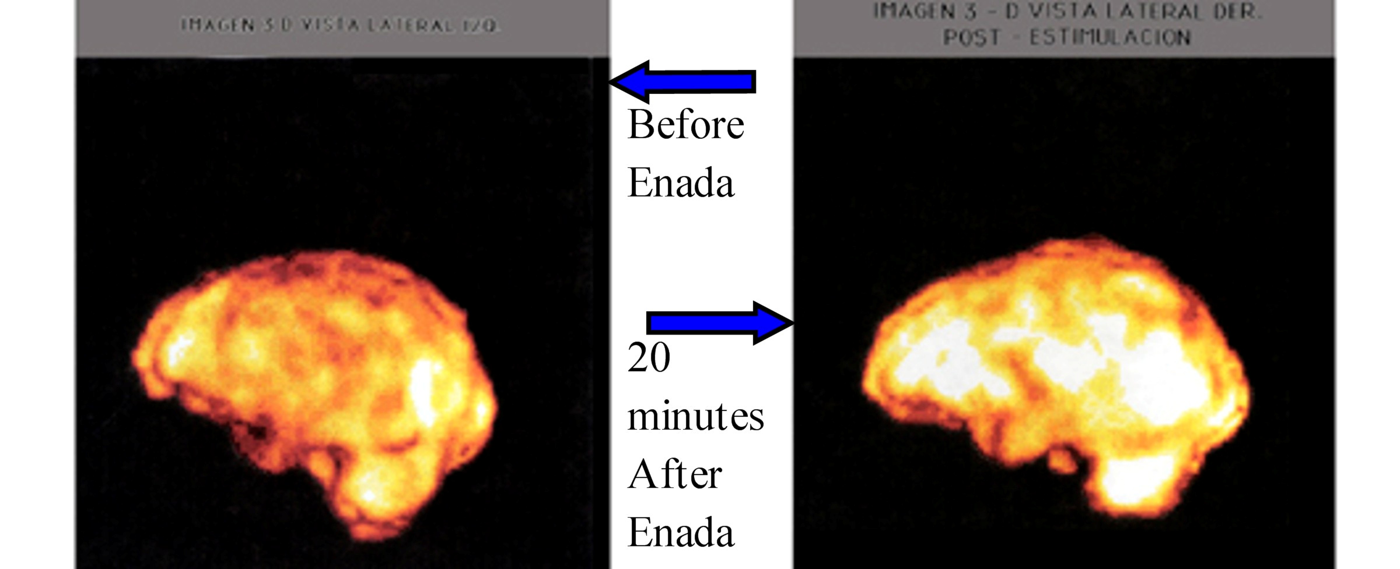 Relationship between the brain and Enada Co-E1 - ENADA The Science ...